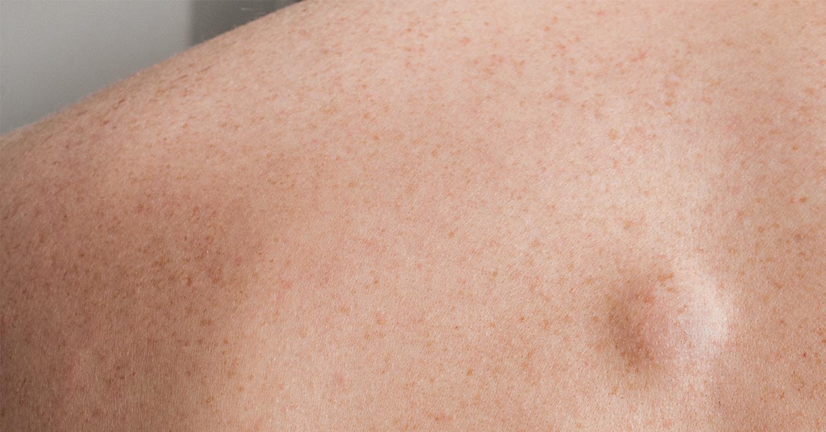 50 Weird Signs That Lead To a Cancer Diagnosis - Tiffy Taffy : Tiffy Taffy