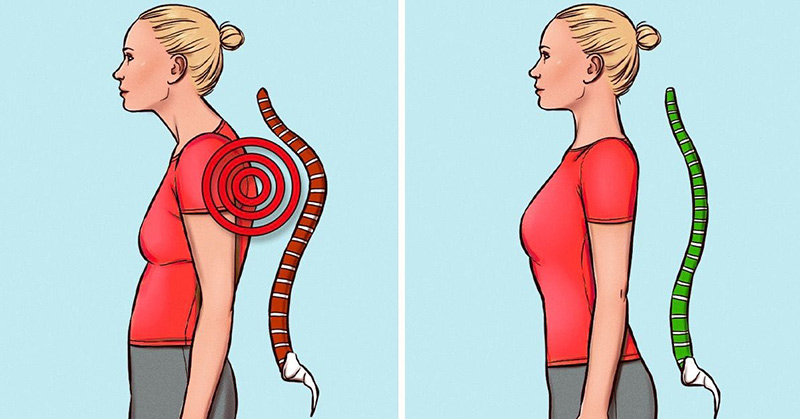 8 Simple Posture Exercises To Reduce Back Pain : Tiffy Taffy