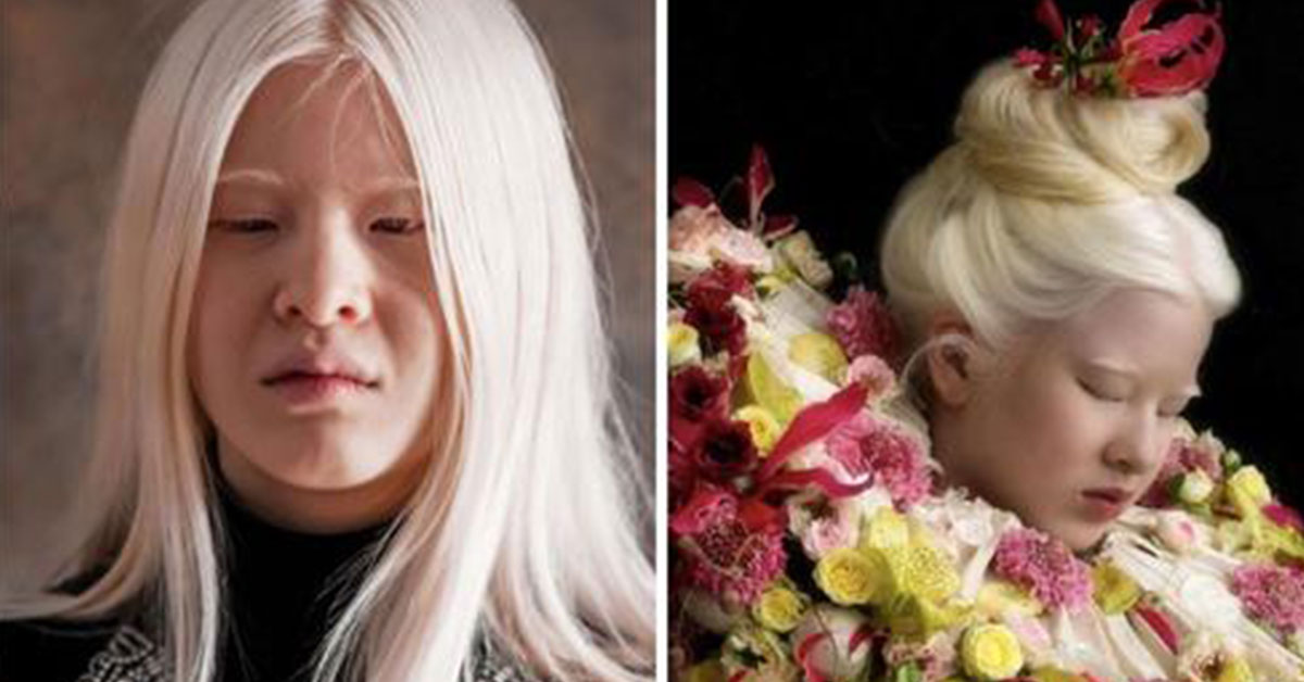 Abandoned By Parents, She Vowed To Prove Them Wrong - Today, She Models ...