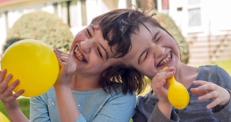 The Incredible Twins Who Share A Brain And Can See Through Each Other's ...